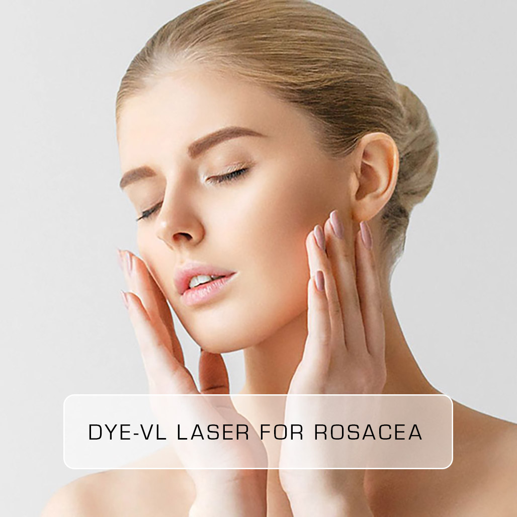 Rosacea Treatment - London Real Skin Clinic | London Real Skin Clinic